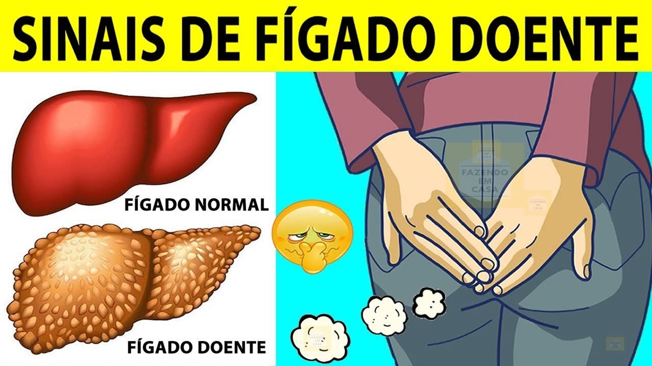 7 sintomas que indicam um problema no fígado - Blog Jejum Intermitente